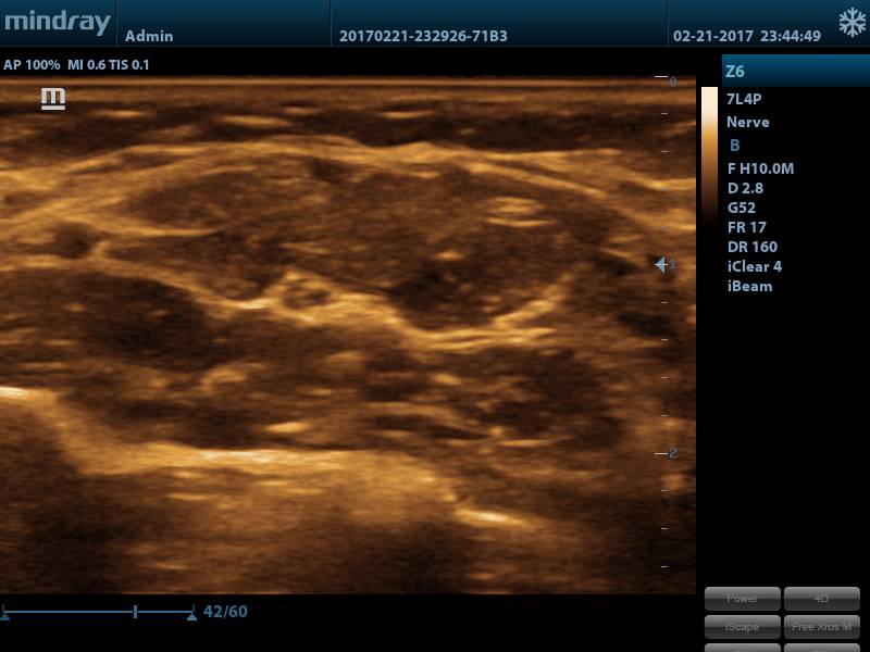 Mindray Z6 – The Ultrasound Source