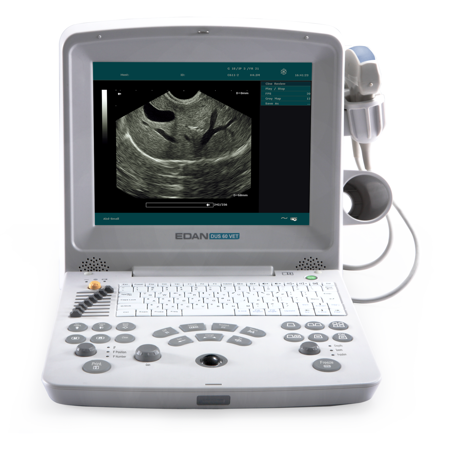 Edan DUS 60 – The Ultrasound Source
