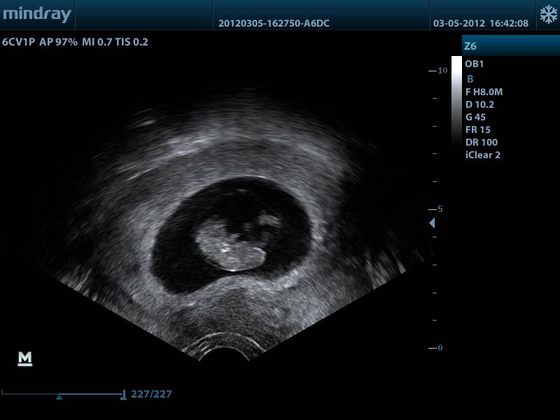Mindray Z6 – The Ultrasound Source