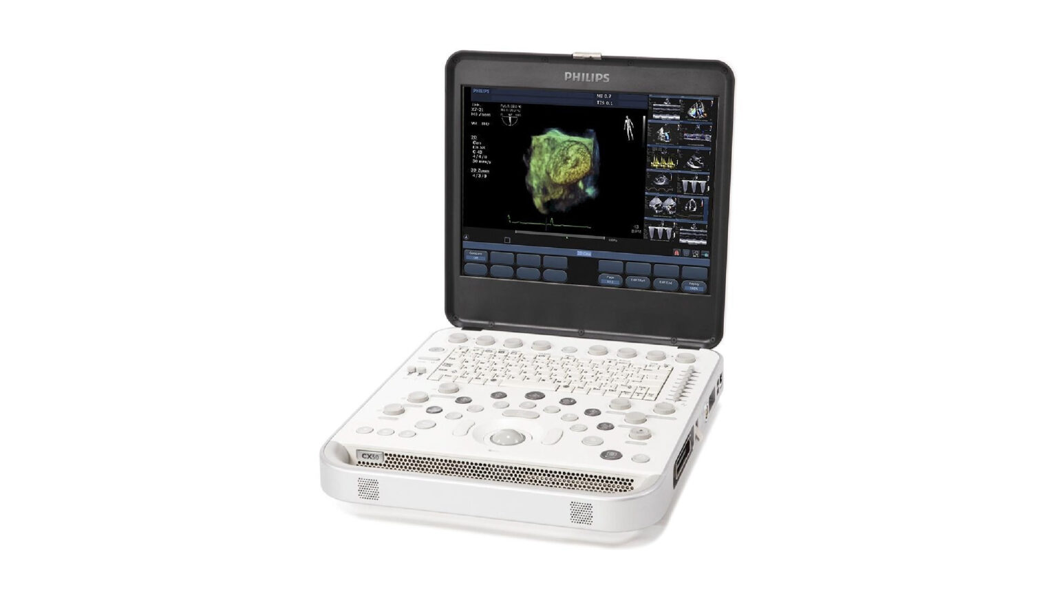 The Best Portable Ultrasound Machines 2020 – The Ultrasound Source