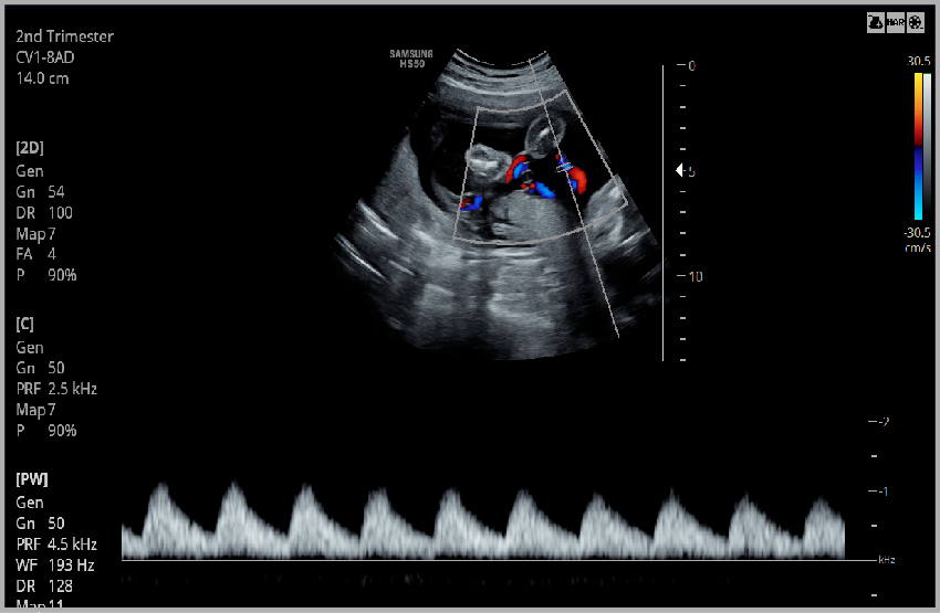 Samsung HS50 – The Ultrasound Source