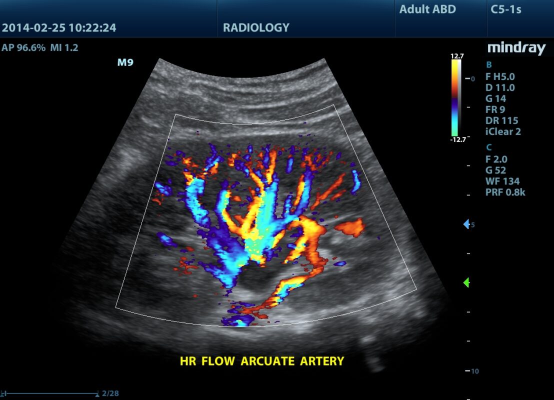 Mindray M9 – The Ultrasound Source