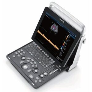 Mindray Z60 – The Ultrasound Source