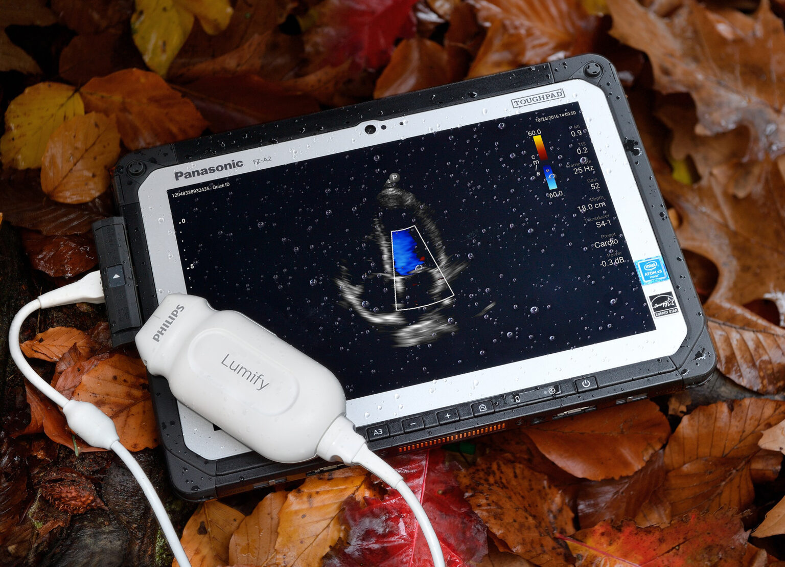 Philips Lumify – The Ultrasound Source