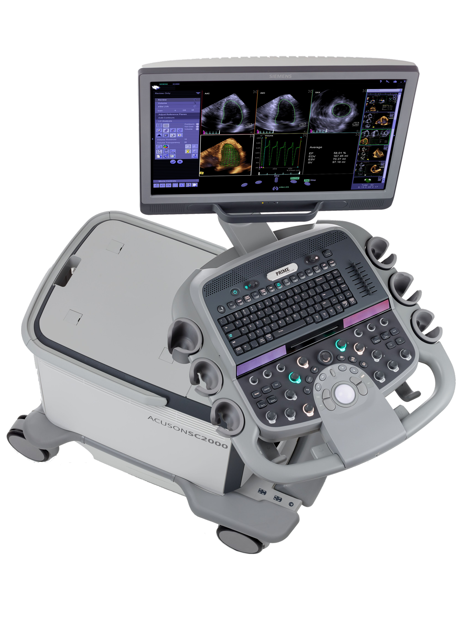 Siemens/Acuson SC2000 – The Ultrasound Source