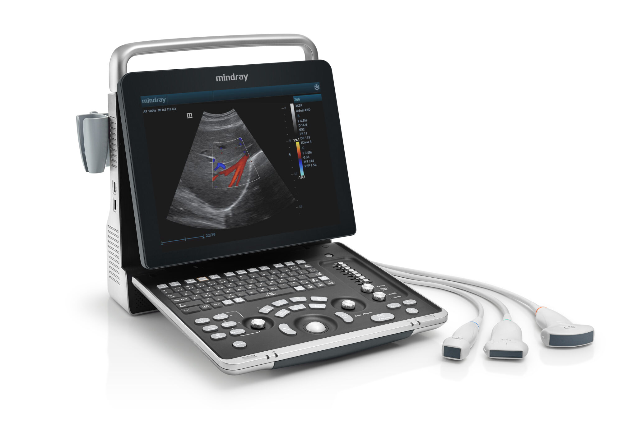 Mindray – The Ultrasound Source