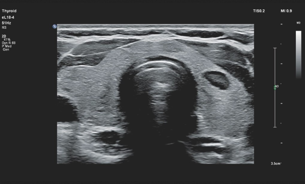 Philips EPIQ 7 – The Ultrasound Source