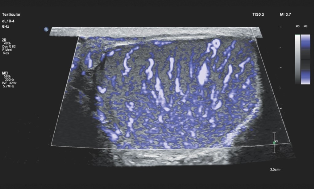 Philips EPIQ 7 – The Ultrasound Source