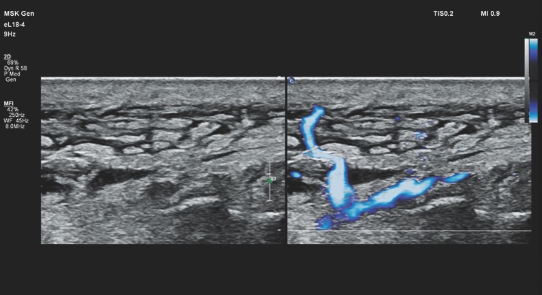 Philips EPIQ 7 – The Ultrasound Source