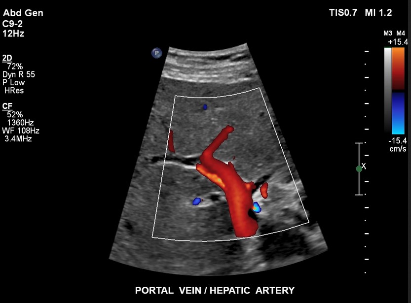Philips EPIQ 7 – The Ultrasound Source