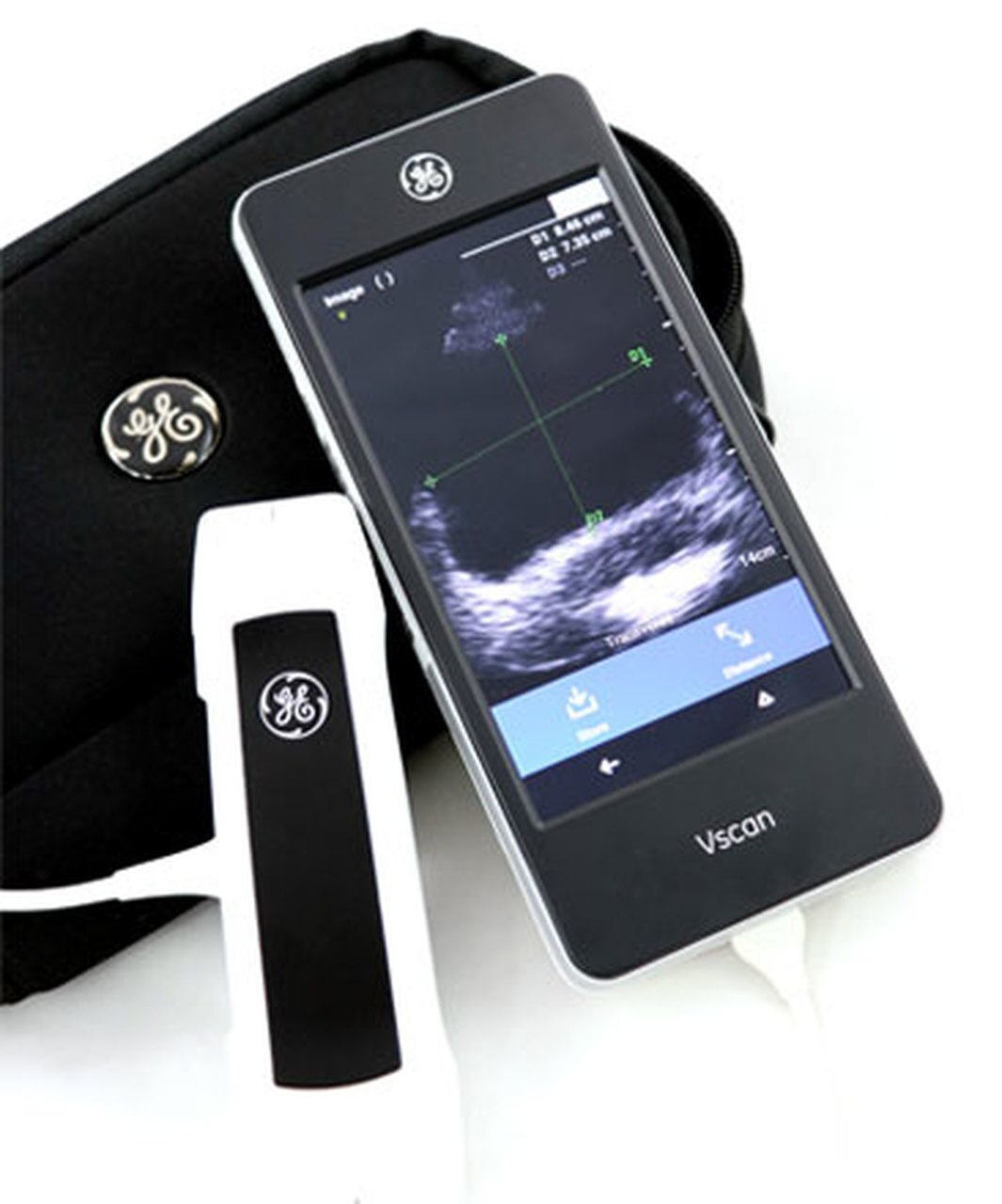 GE Vscan Extend – The Ultrasound Source