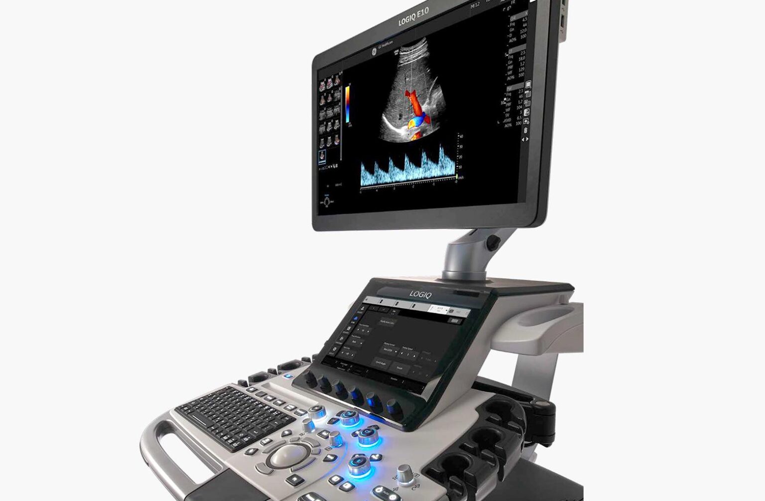GE Logiq E10 – The Ultrasound Source