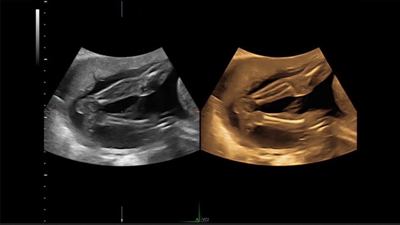 GE Voluson S8 with Touch Panel – The Ultrasound Source