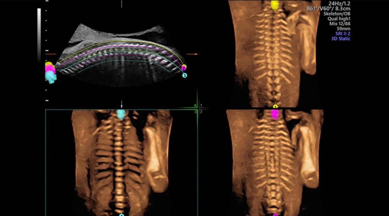 GE Voluson S8 with Touch Panel – The Ultrasound Source
