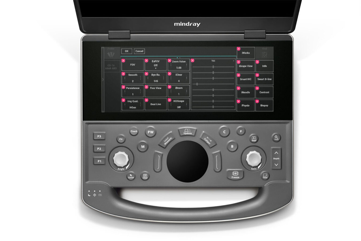 Mindray ME8 – The Ultrasound Source