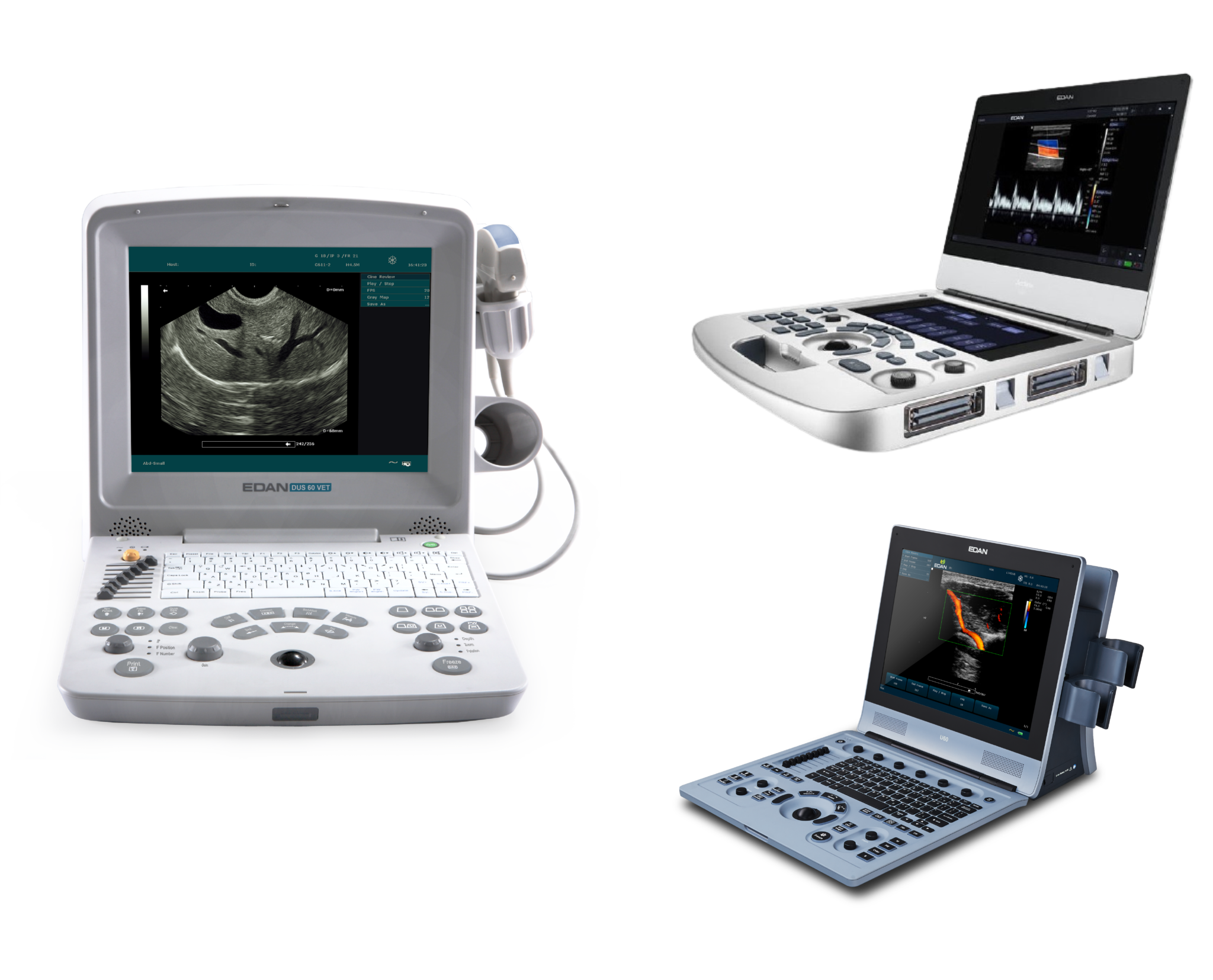 Edan – The Ultrasound Source