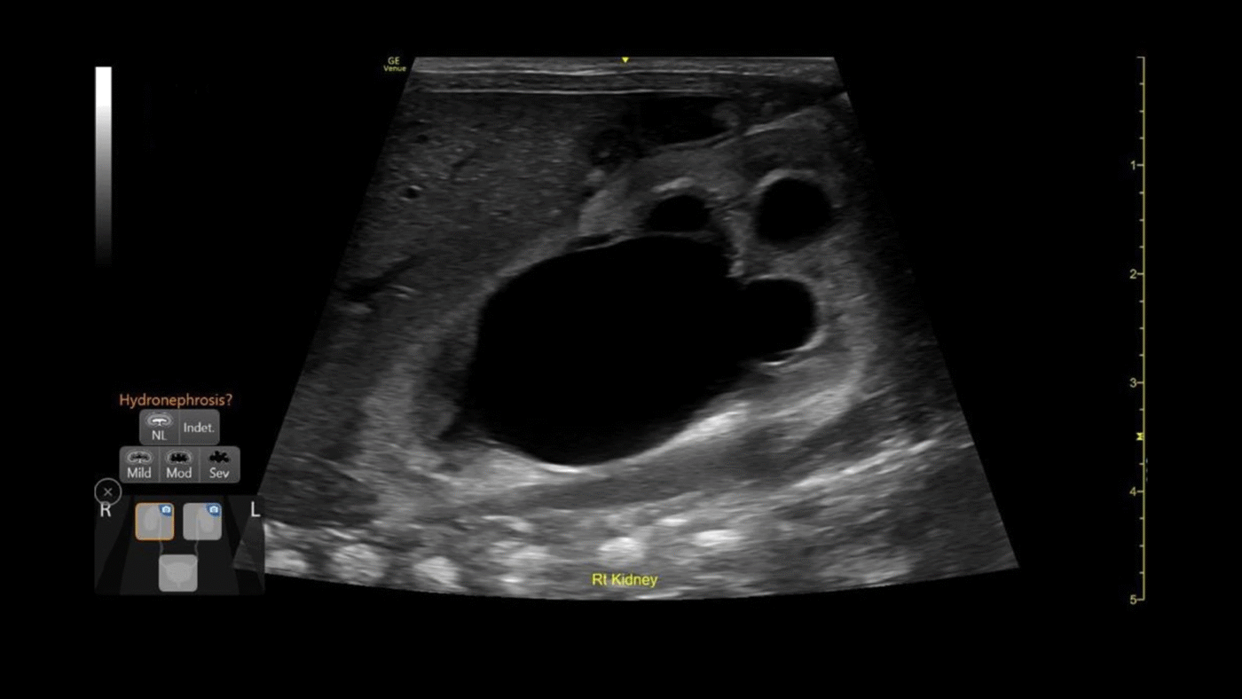 GE Venue R4 Ultrasound System – The Ultrasound Source